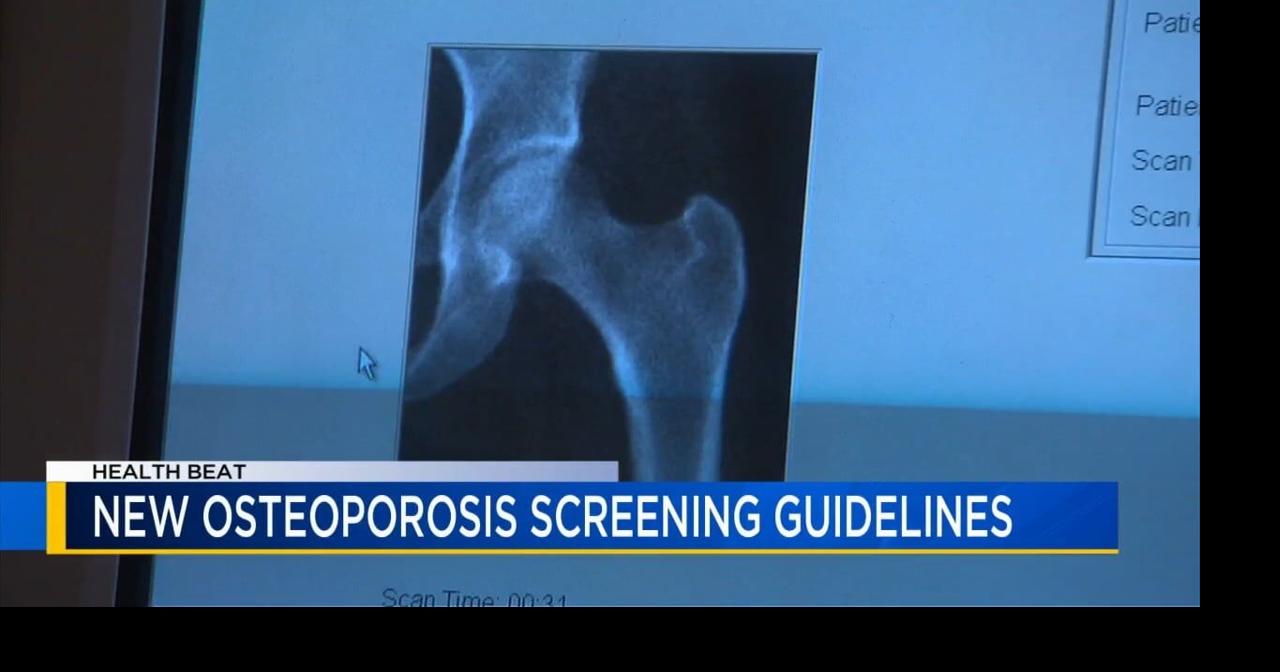Health Beat: New osteoporosis screening guidelines | Health Beat | wfmz.com