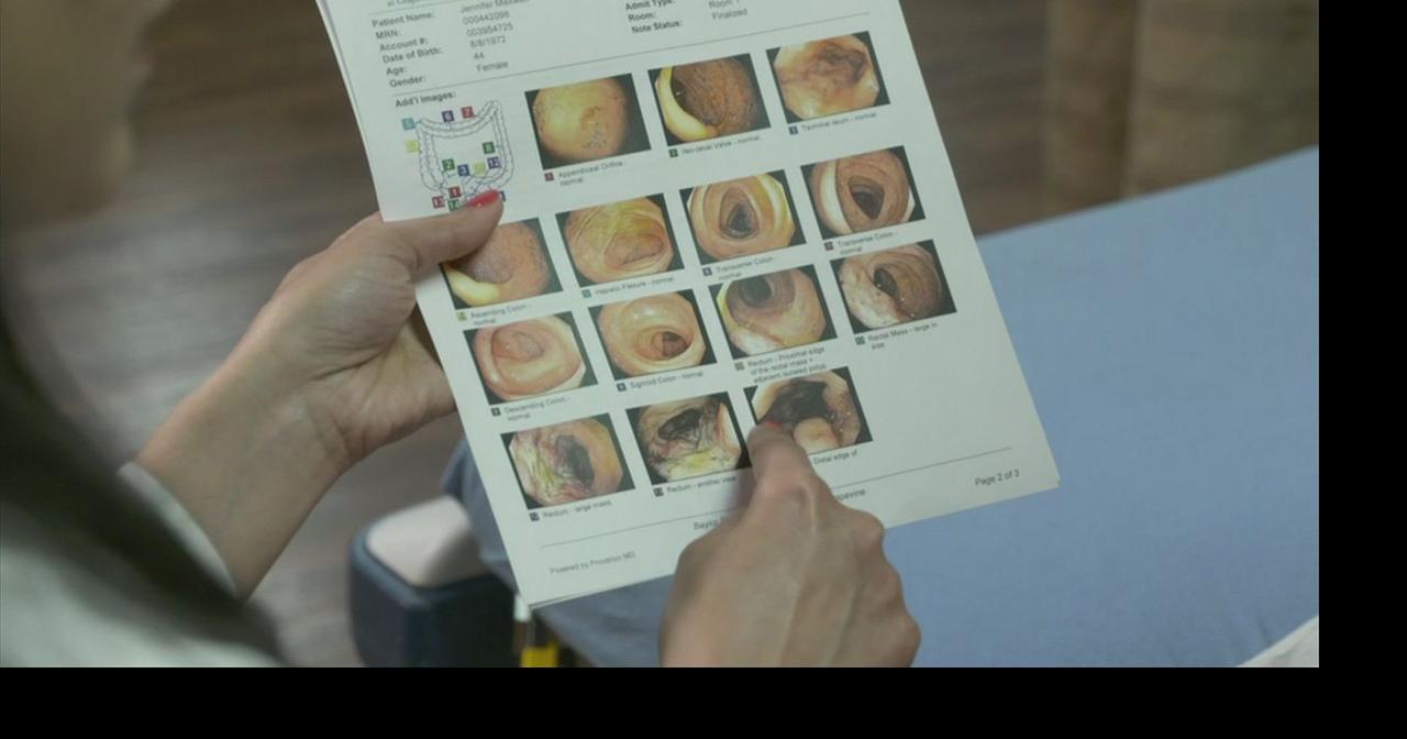 Colon cancer in the young is on the rise | Health | wfmz.com