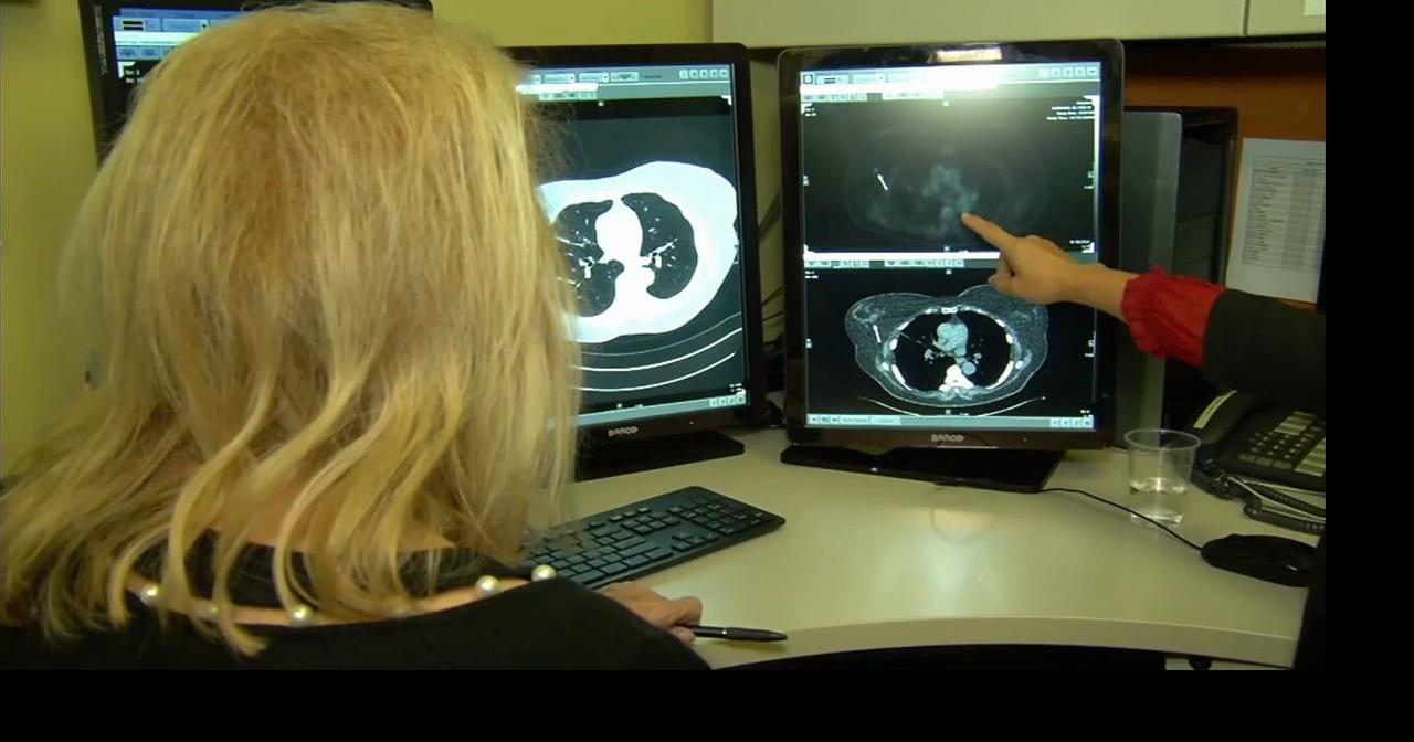 Health Beat: Cancer screening guidelines | Health Beat | wfmz.com