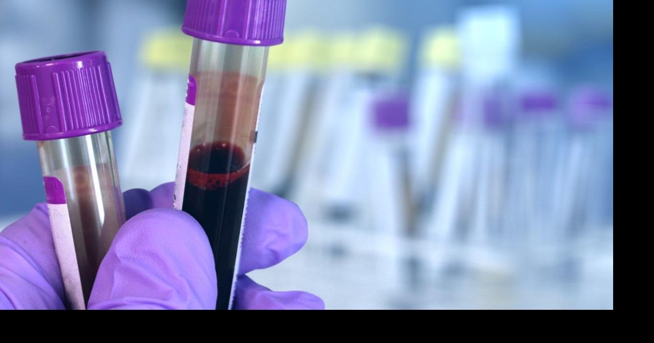 Health Beat: HIV & teens: Prevention, diagnosis and cure | Health Beat ...