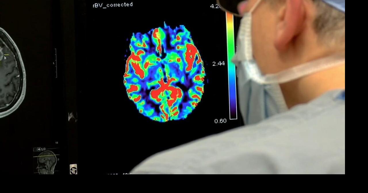 Health Beat: Immunotherapy targets brain cancer | Health Beat | wfmz.com