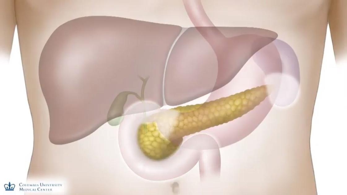 Health Beat Can You Live Without A Pancreas Video Wfmz health-beat-can-you-live-without-a-pancreas-video-wfmz