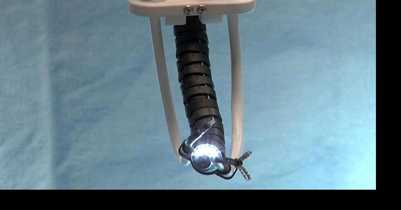 Health Beat: Robotic snake treats head, neck tumors | Health | wfmz.com