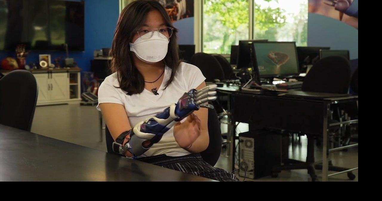 Health Beat: Bionic arms for kids | Health Beat | wfmz.com