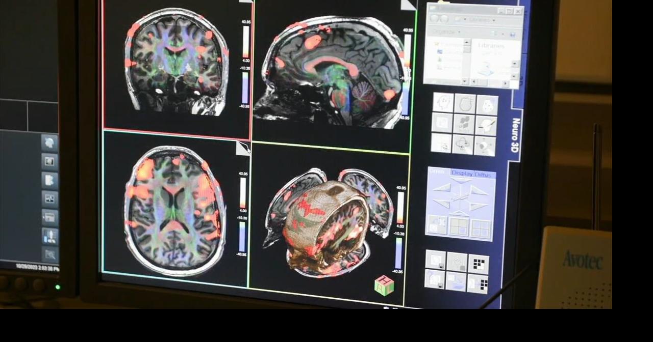 Health Beat: 7 Tesla MRI treats epilepsy | Health Beat | wfmz.com