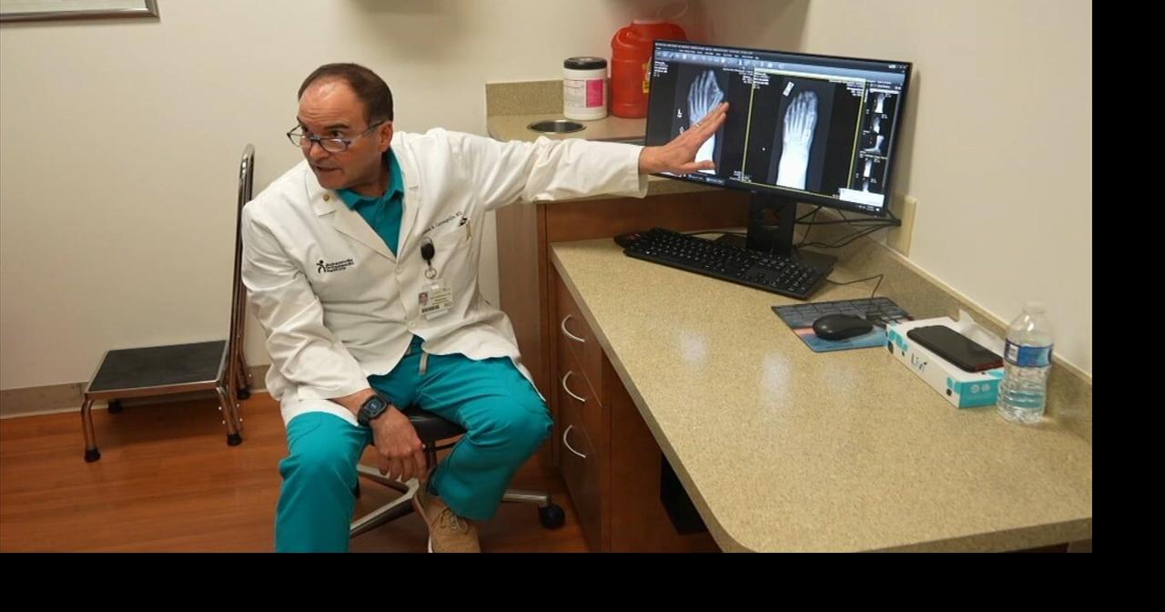 Health Beat: Breakthrough bunion procedure | Health Beat | wfmz.com