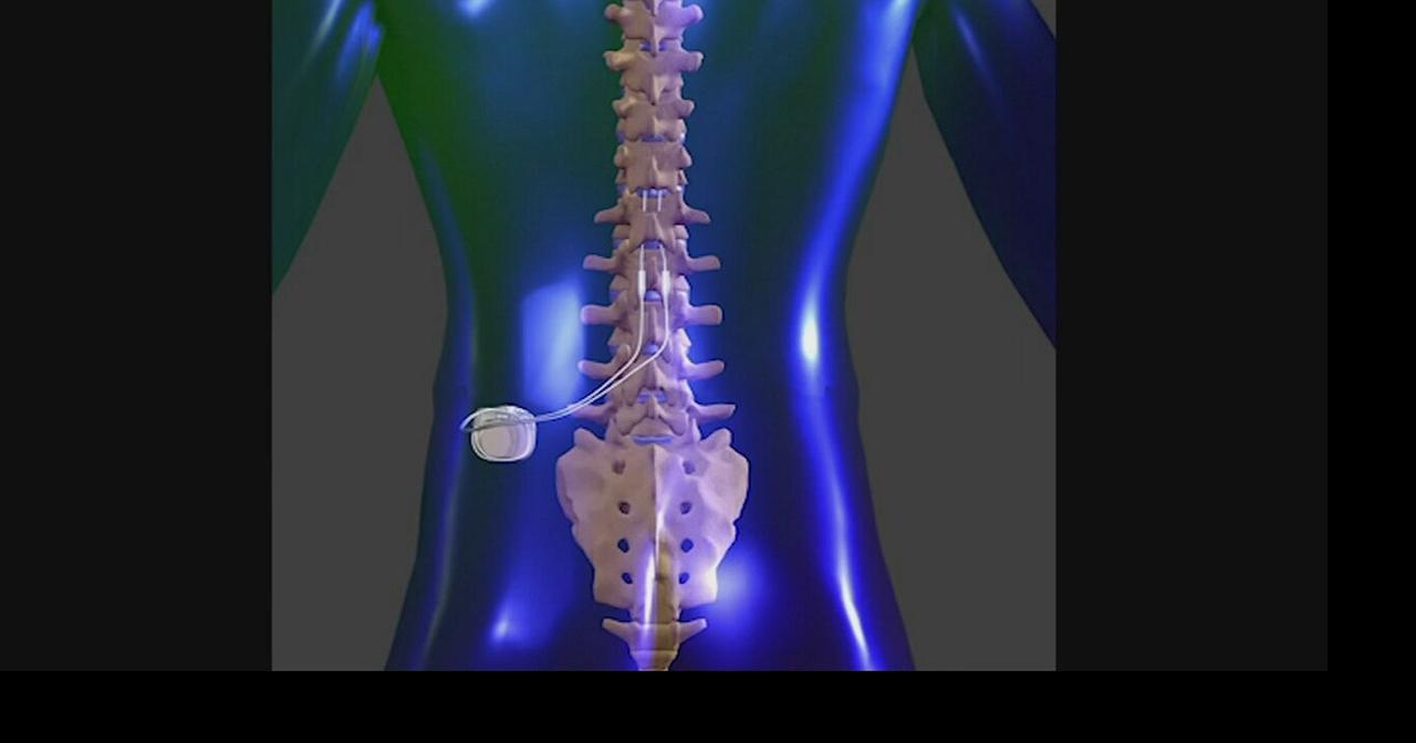 Health Beat: Injectrode to better treat neurodegenerative diseases ...