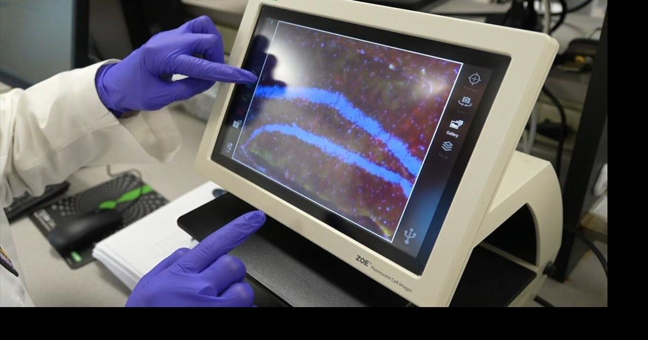 Health Beat: Brain cells after a stroke | Health Beat | wfmz.com