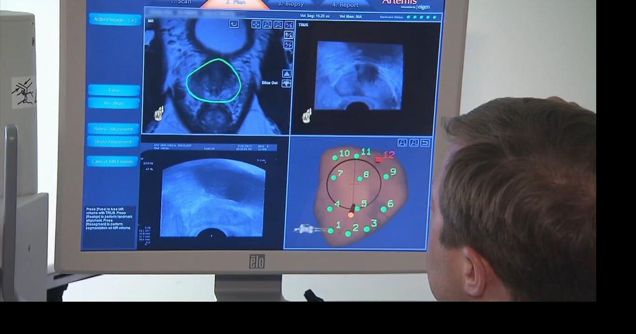 Health Beat: Prostate cancer screening | Health Beat | wfmz.com