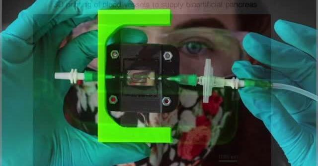 Health Beat: Close to a T1D Cure: New Insulin Regulating Implant ...