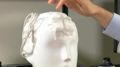 Health Beat: Battling brain tumors with Optune | Health | wfmz.com