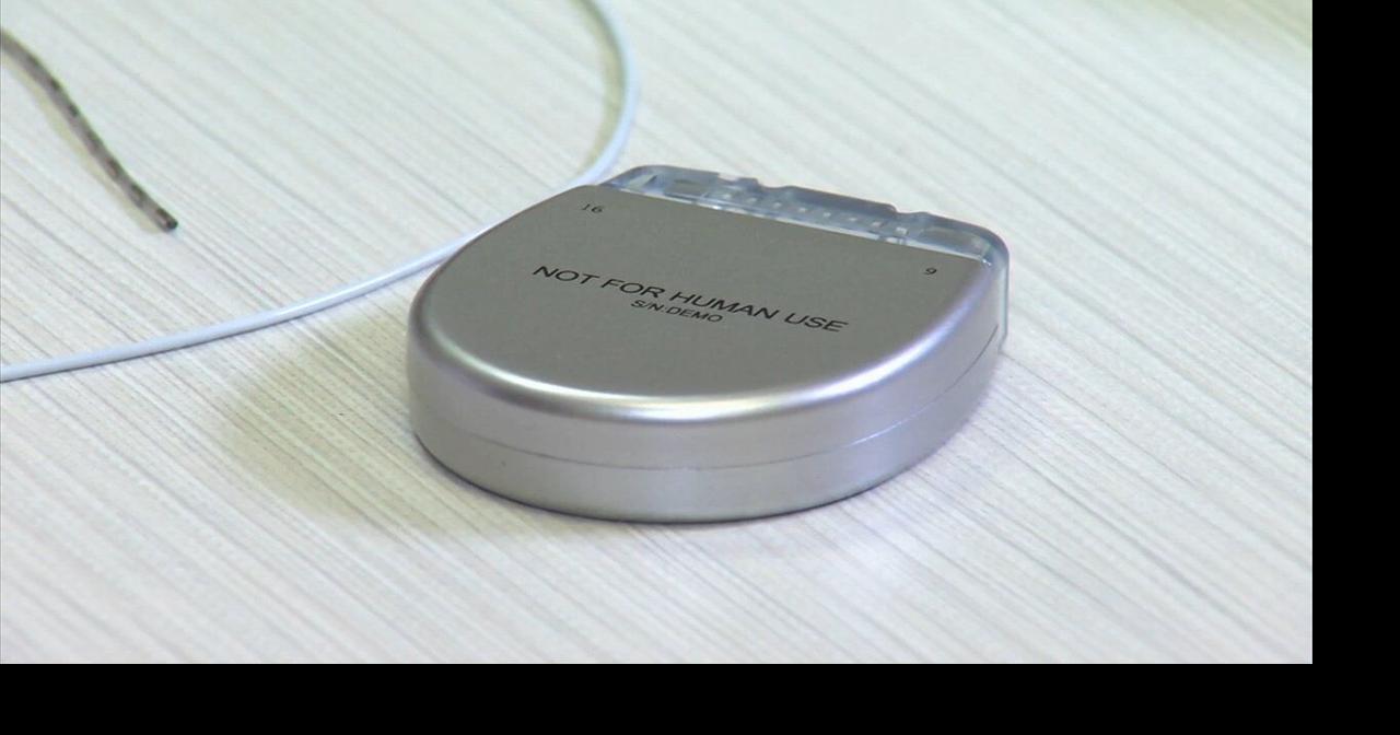 Health Beat: Spinal stimulator relieves back pain | Health Beat | wfmz.com