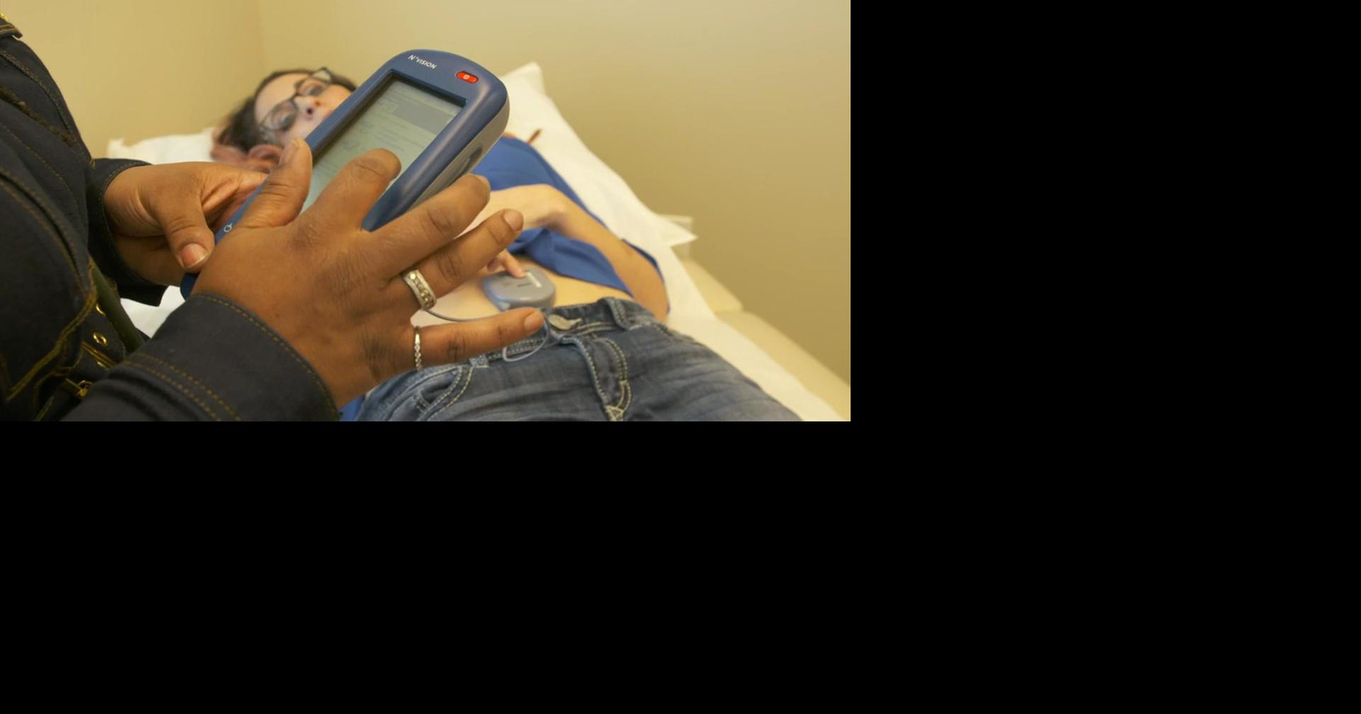 Health Beat: Pacemaker treats stomach paralysis | Health | wfmz.com