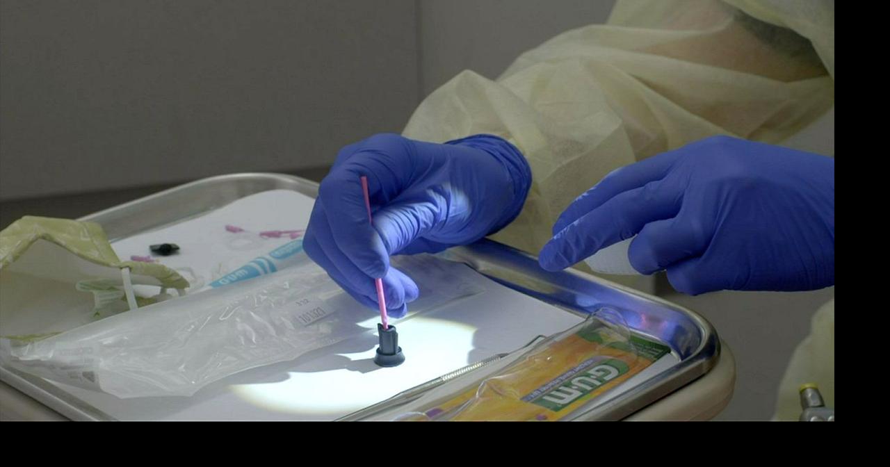 Health Beat: Using SDF to fill kids' cavities pain-free | Health Beat ...