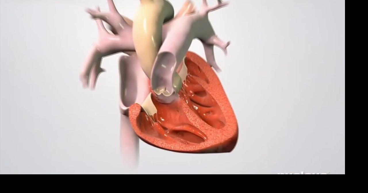 Health Beat: Harmony valve keeps hearts humming | Health Beat | wfmz.com