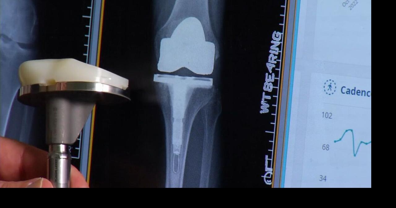 Health Beat: Smart knee replacement | Health Beat | wfmz.com