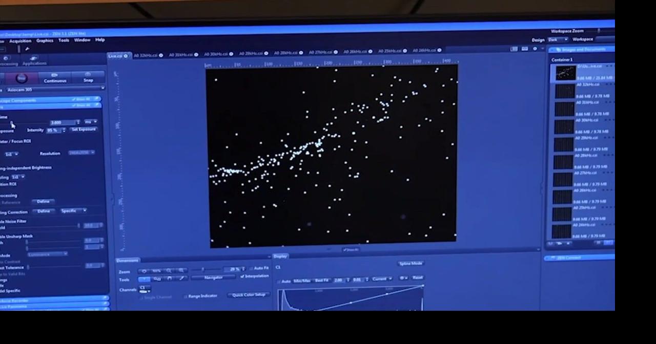 Health Beat: The future of medical microbots | Health Beat | wfmz.com