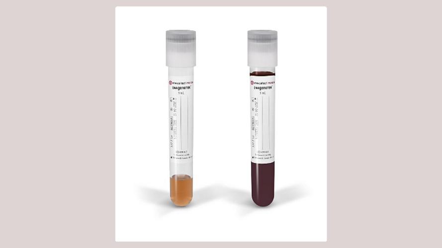 OraSure launches new blood collection device | Business News | wfmz.com