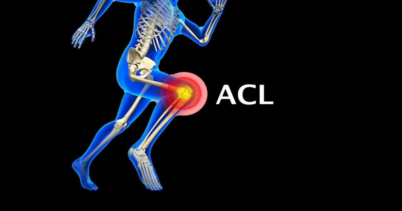 Health Beat: Marshmallow implant heals ACL from the inside out | Health ...
