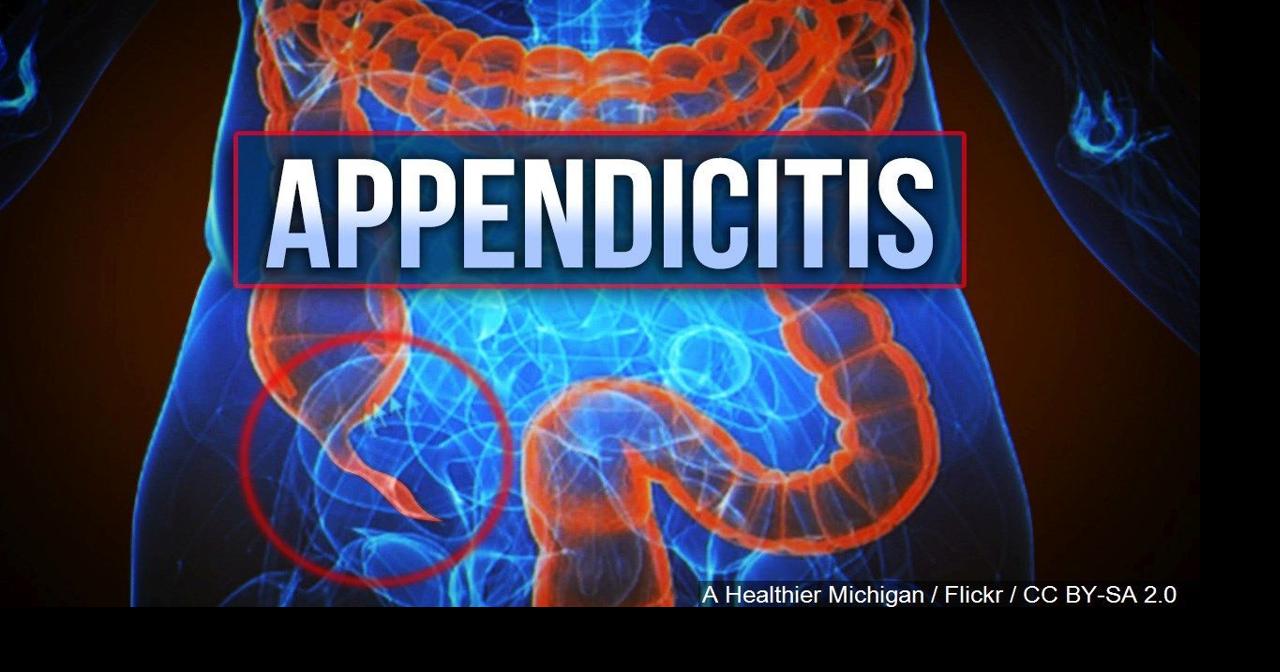 Health Beat: Antibiotics treat appendicitis: No surgery needed | Health ...