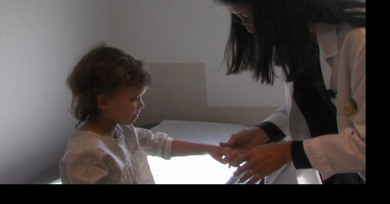 Health Beat: Bioabsorbable implants for bone fractures | Health Beat ...