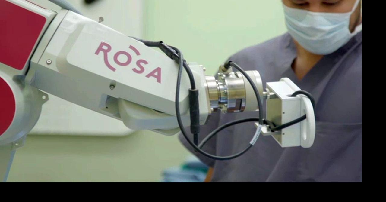 Health Beat: Robotic ROSA enables doctors to stop seizures | Health ...
