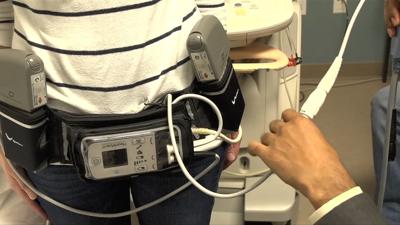 Health Beat: Living with LVAD | Health Beat | wfmz.com