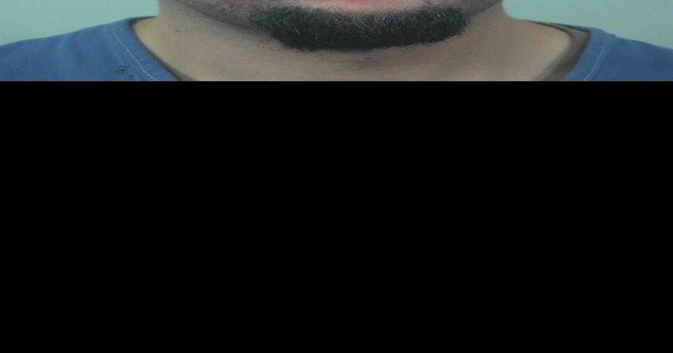 Marshall man arrested after fender-bender turns “chaotic” | Archive ...