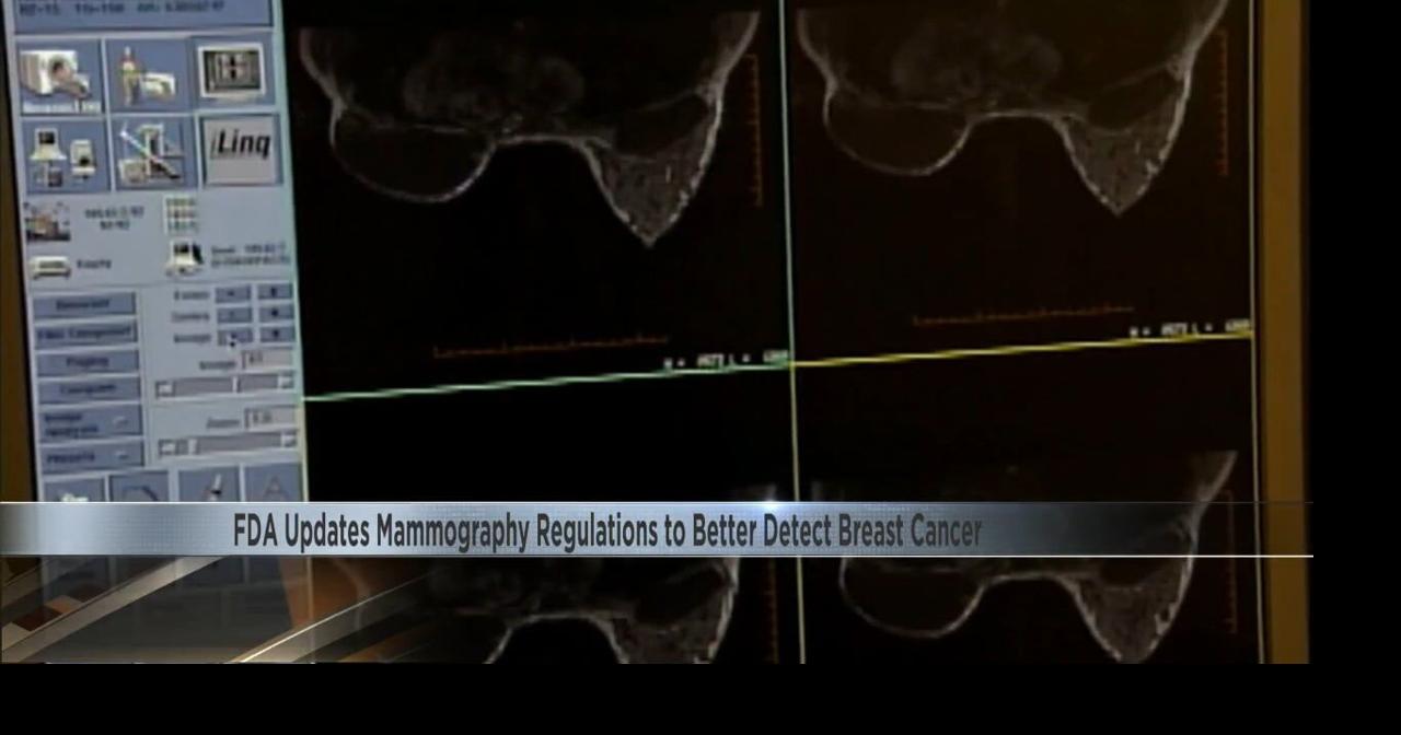 FDA releases updated mammogram standards to better detect breast cancer ...