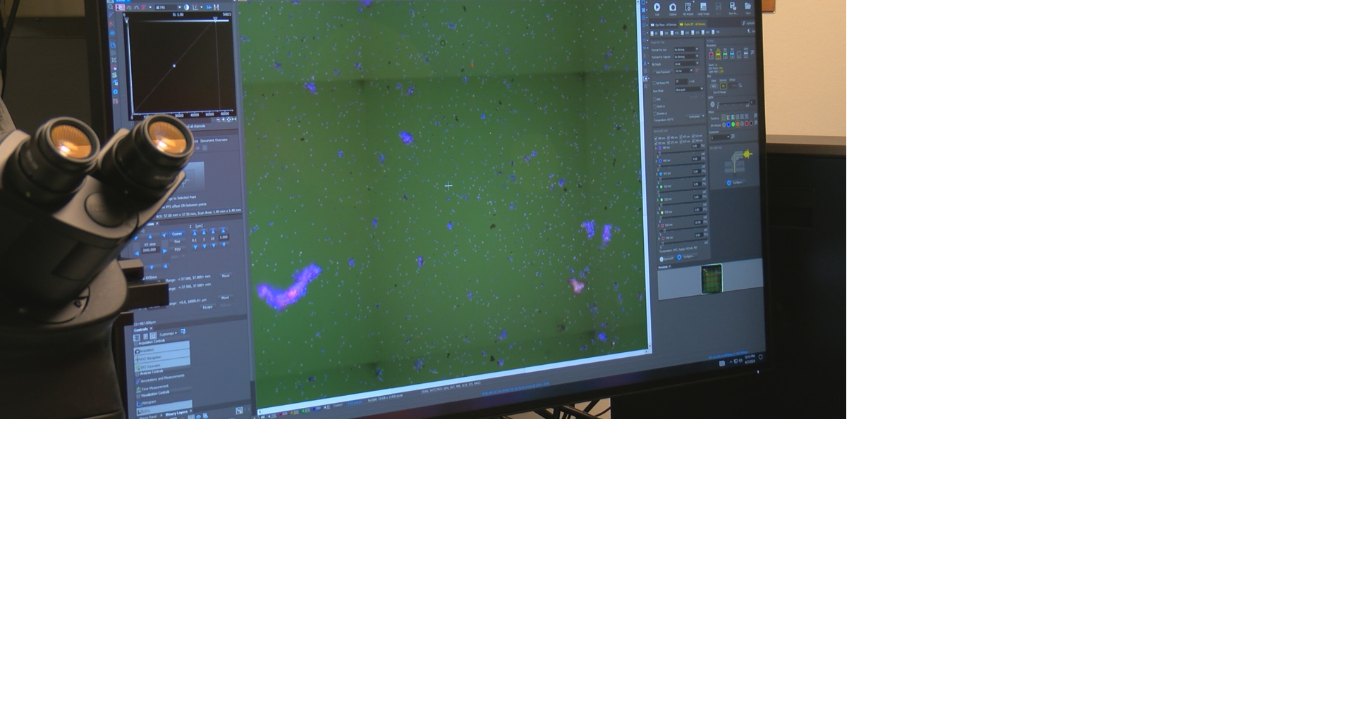 UW Carbone Cancer Center celebrates 50 years, highlights new research ...