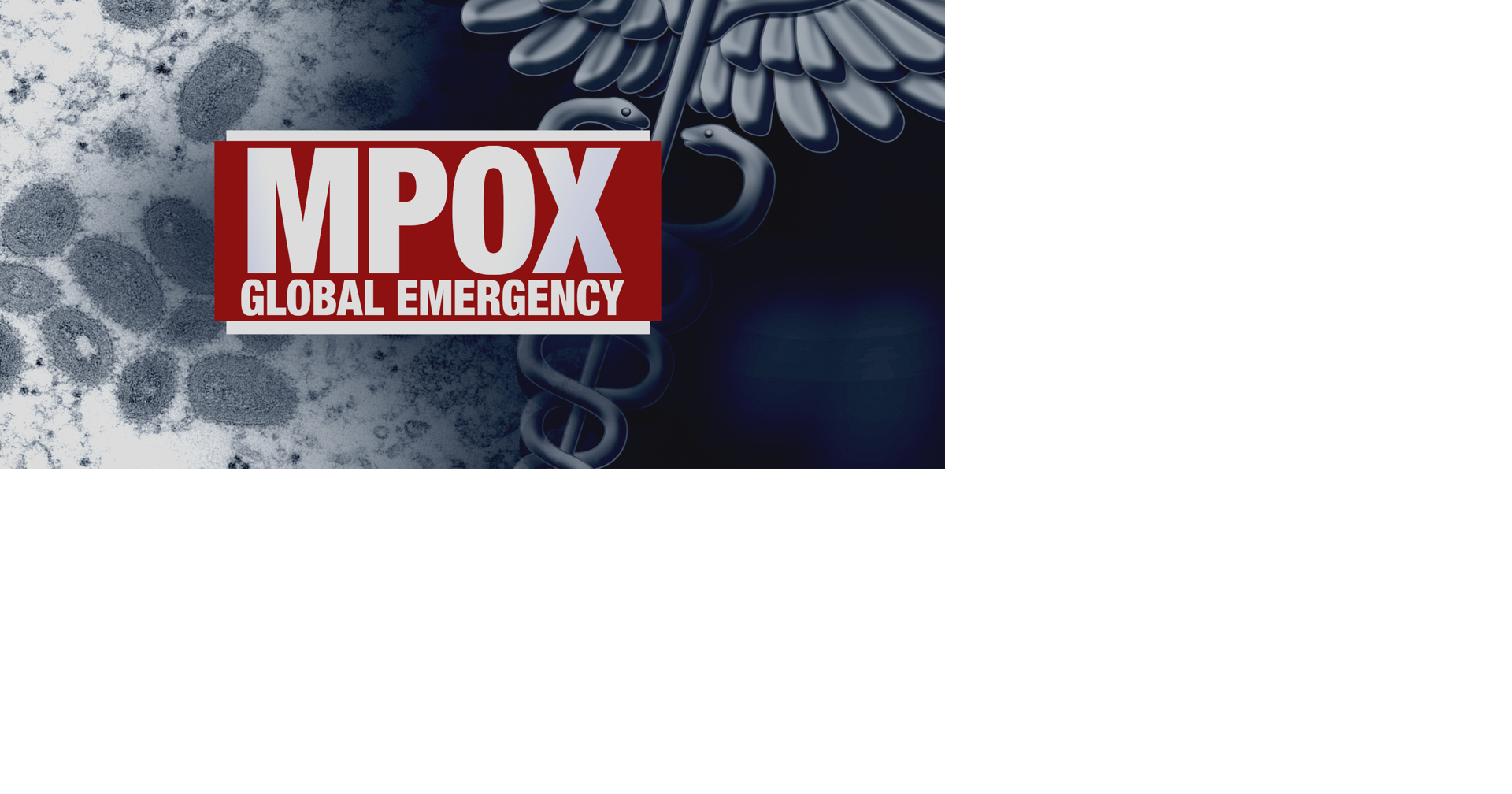 Oneida County Health Dept.: Local Mpox Cases from 2022 and 2023; 'No ...