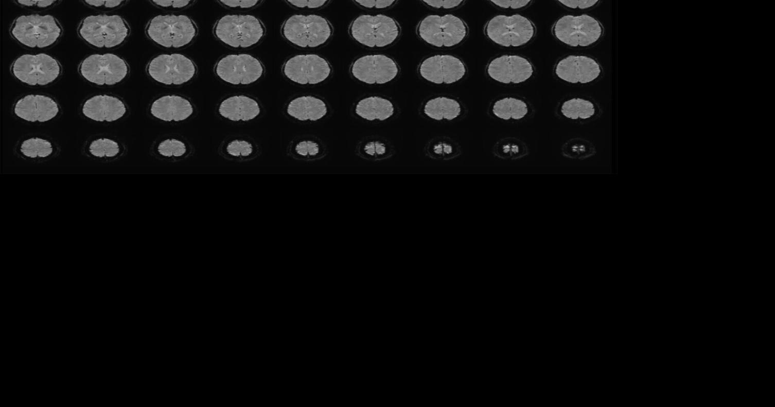 Scientist Turns People’s Mental Images Into Text Using ‘Mind-Captioning ...