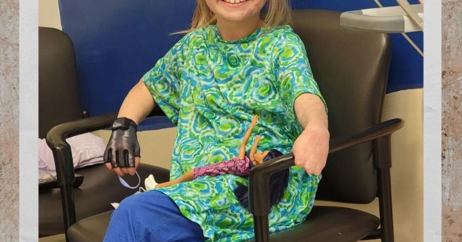 Burn survivor looks back on 5 year burn-aversary | Local | wlfi.com