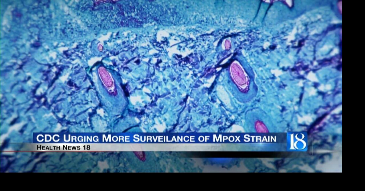 Health News 18: CDC urging more surveillance of Mpox strain | Video ...