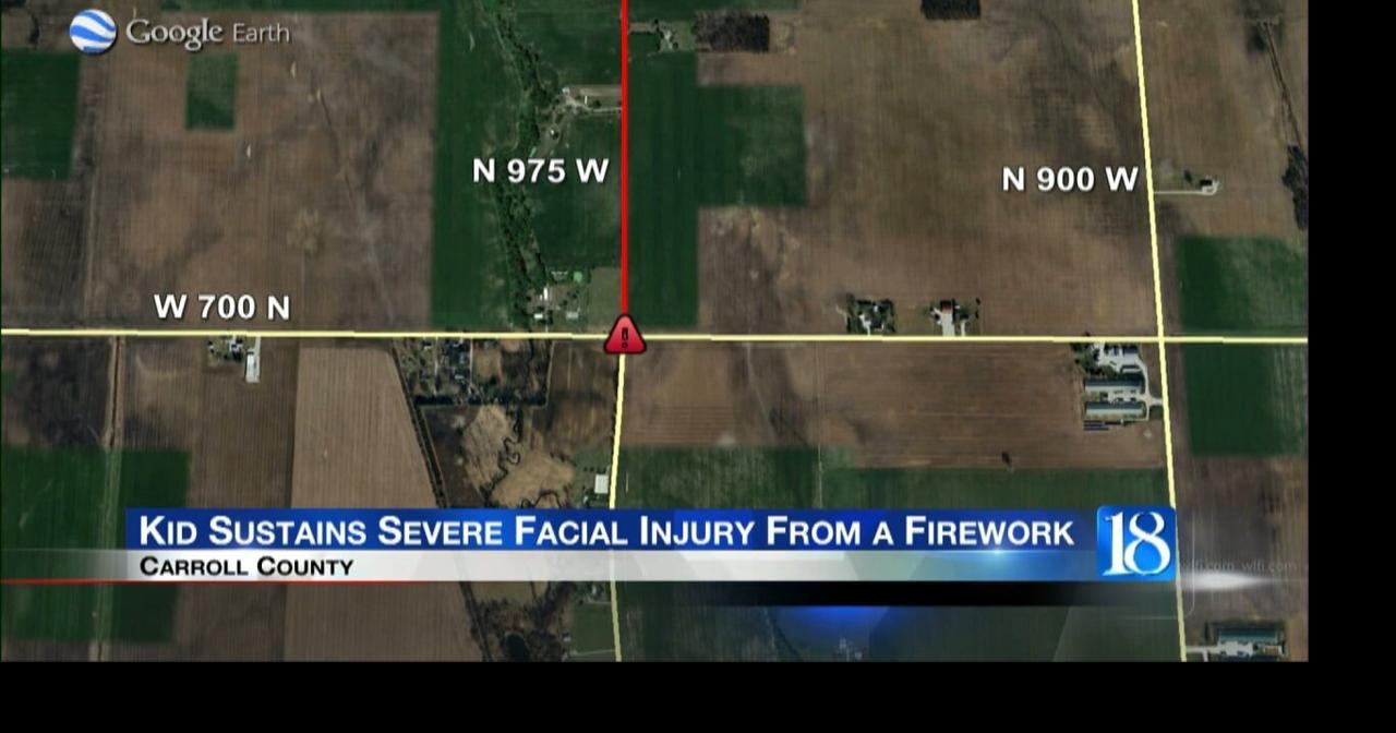 Kid Sustains Severe Facial Injury From a Firework | Video | wlfi.com