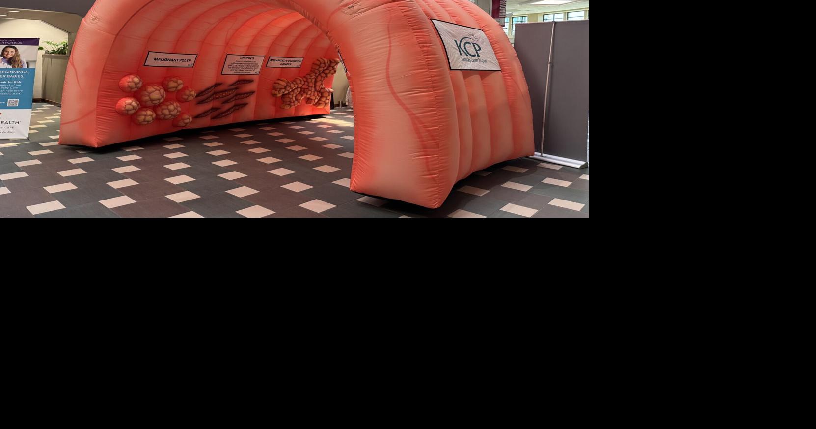 Inflatable display, local surgeon educate visitors on colon cancer ...
