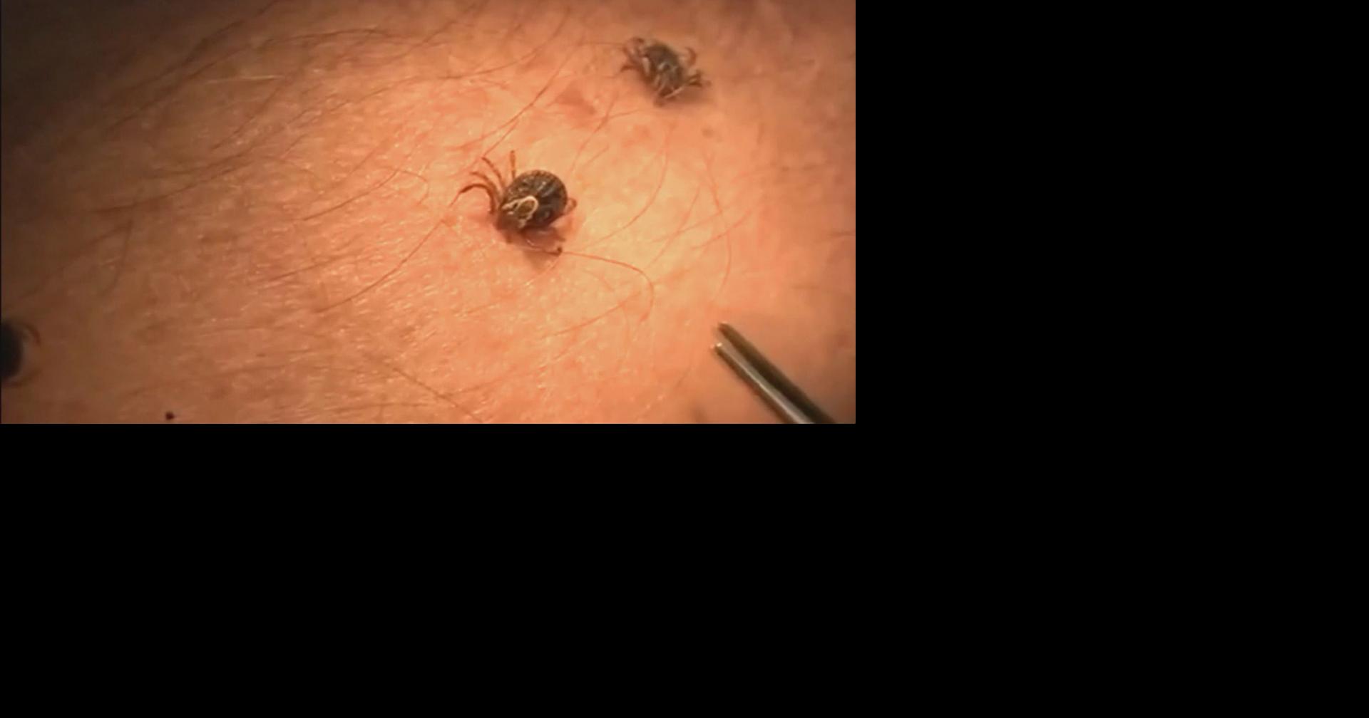 Tick season is coming early; local experts say the time to prepare is ...