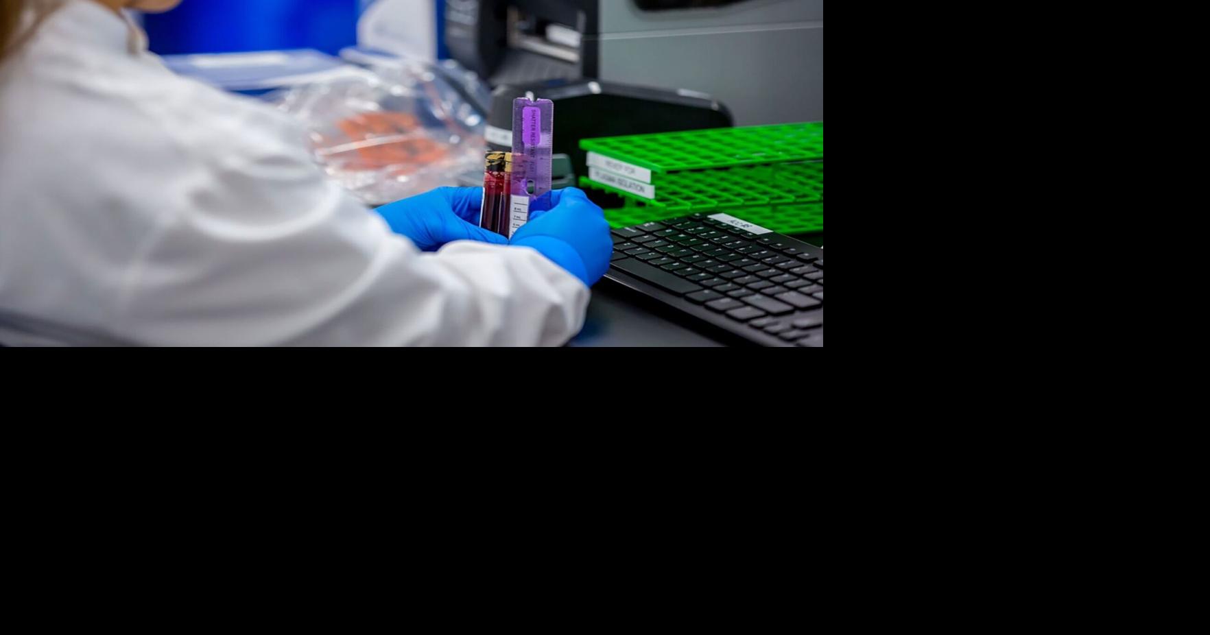 Blood test to detect colon cancer could move a step closer to FDA ...