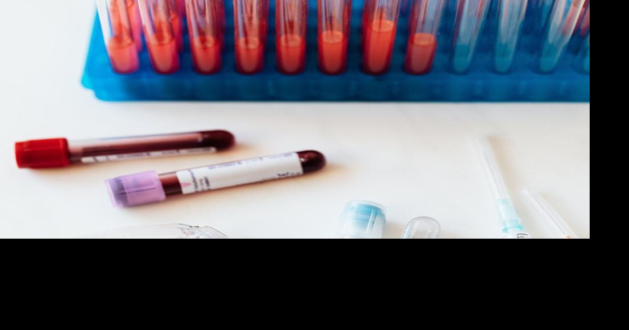 HIV infections could jump over 6 times if US support is dropped and not ...