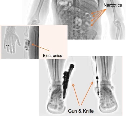 Williamson County Jail now using whole-body x-ray scanner to detect ...