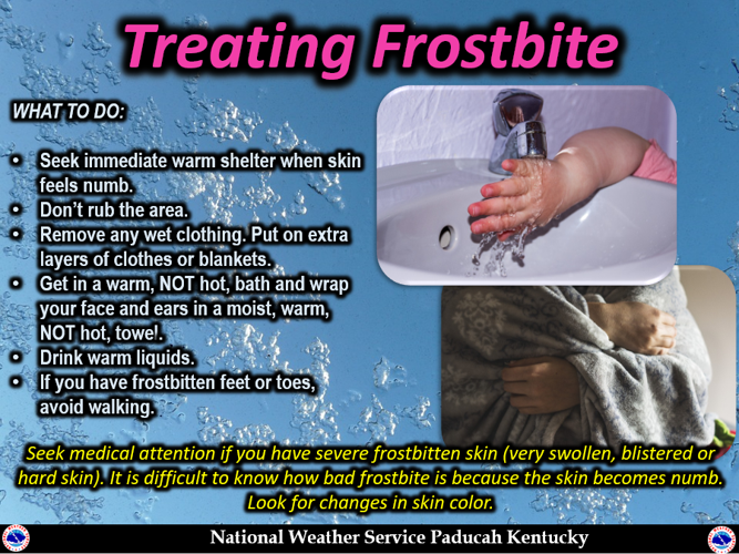 Frostbite: What you need to know | News | WPSD Local 6