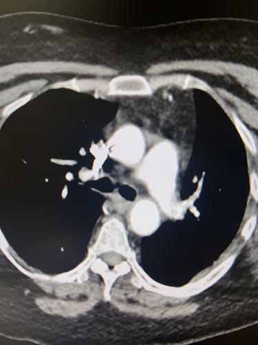 New CT machine scans 4 times faster than other CT scanners | News ...
