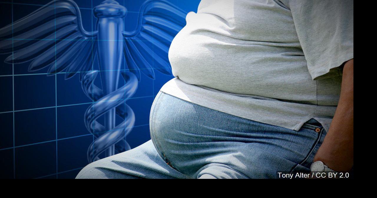 Severe obesity is on the rise in the US | Health | WPSD Local 6