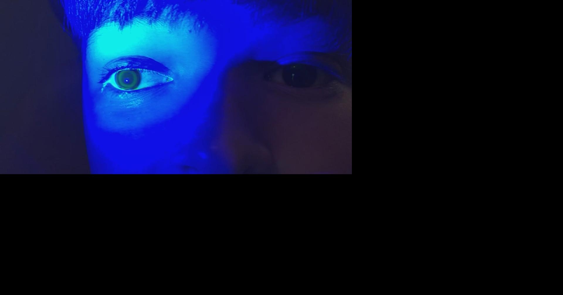 Non-surgical option helping improve vision for nearsighted kids ...