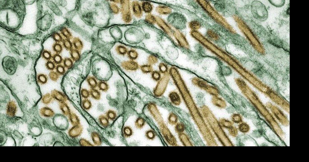CDC: Human case of avian influenza reported in Colorado | News | WPSD ...