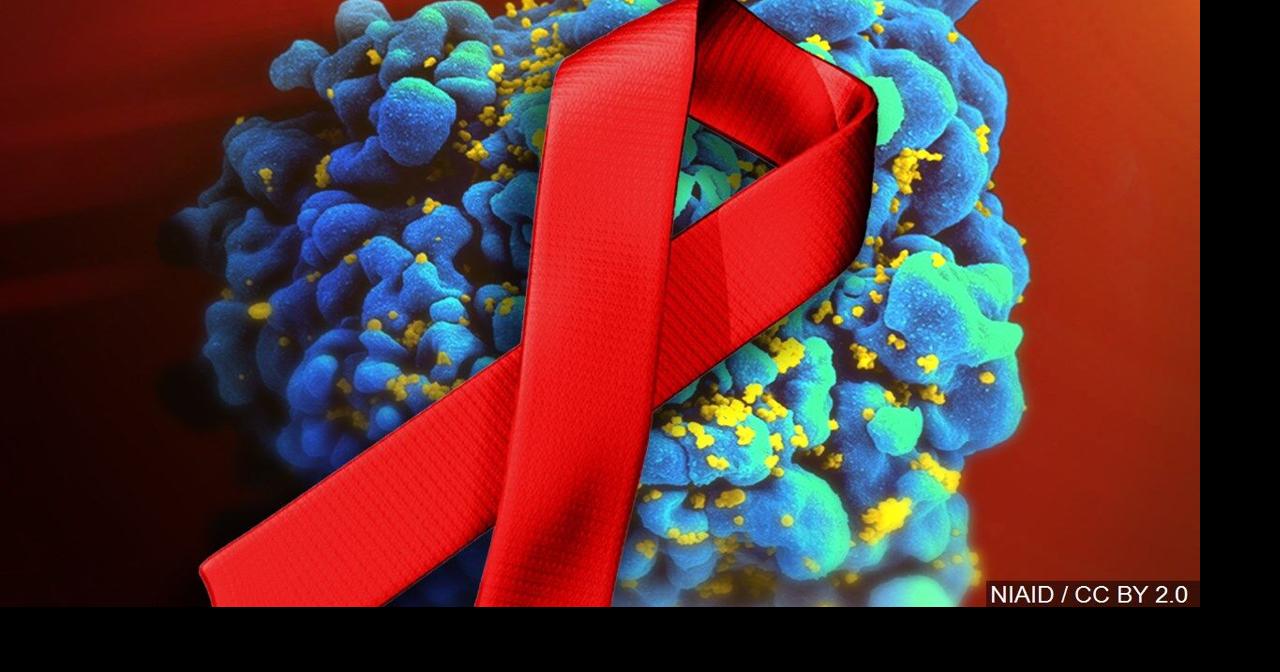 40 years since first diagnosis of AIDS in the United States | News ...