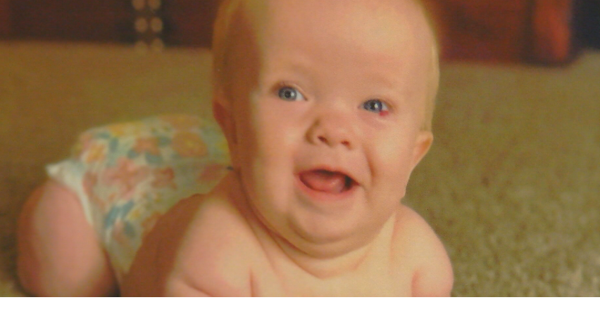 Mom shares infant daughter’s story for Dwarfism Awareness Day | Wake Up ...