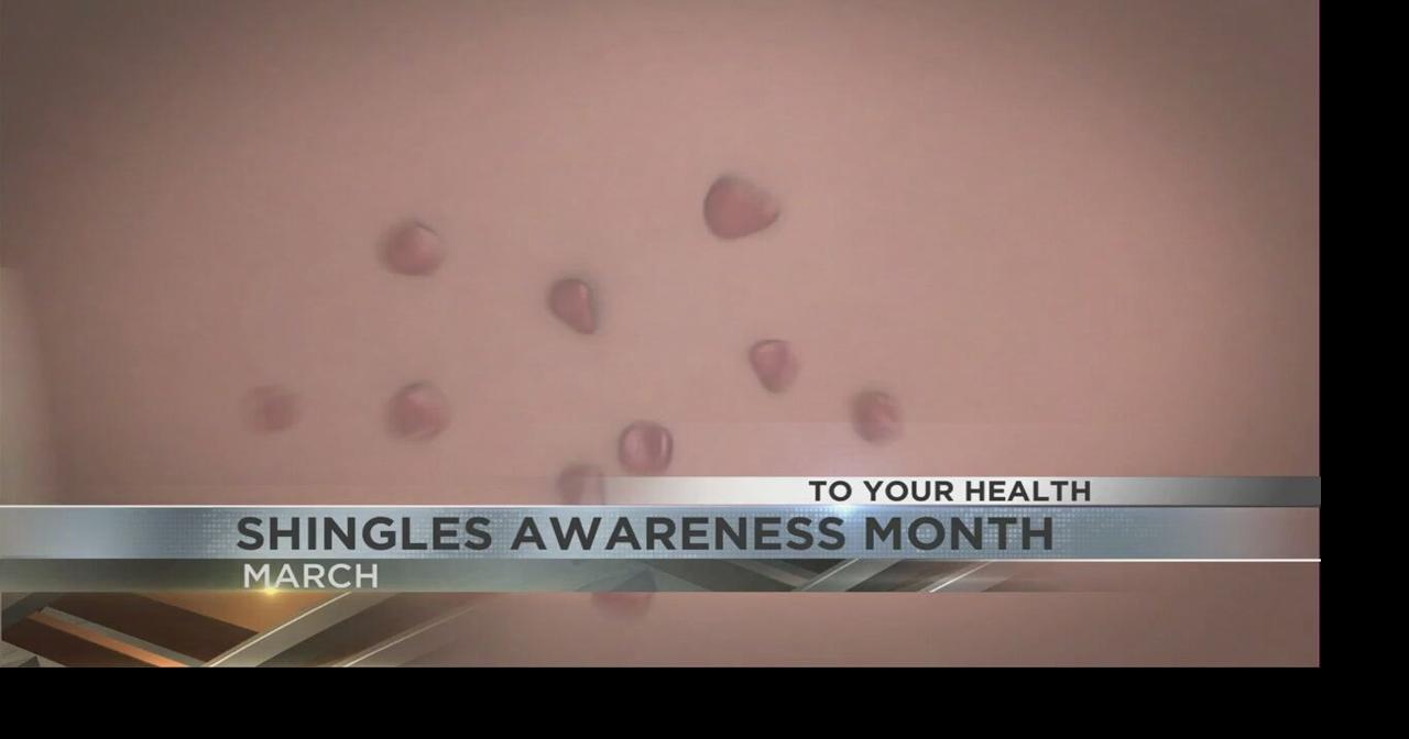 March is shingles awareness month | News | wsiltv.com
