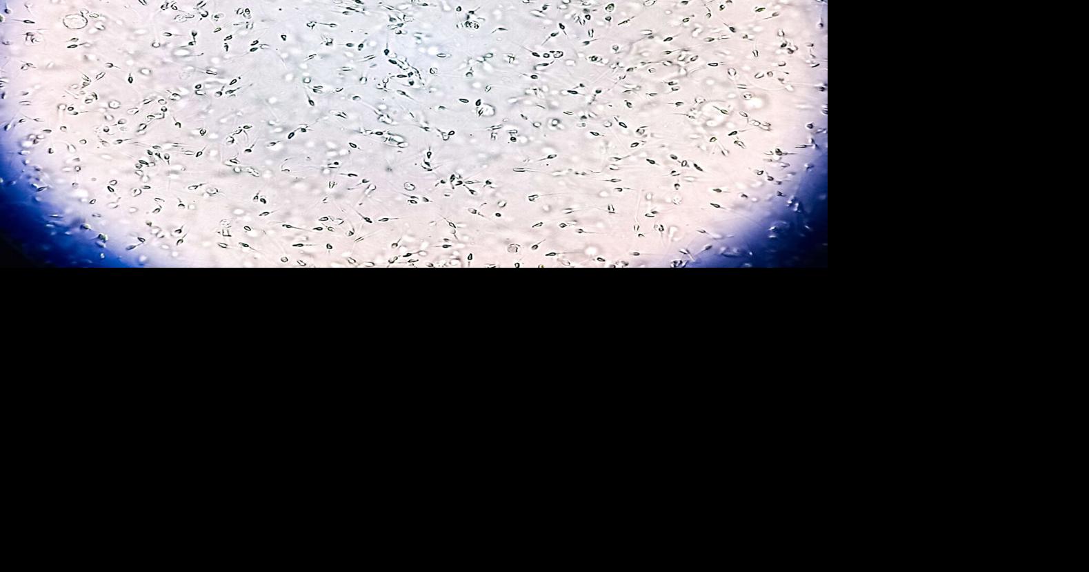 Sperm donor with rare genetic mutation fathered 67 children. Ten now ...