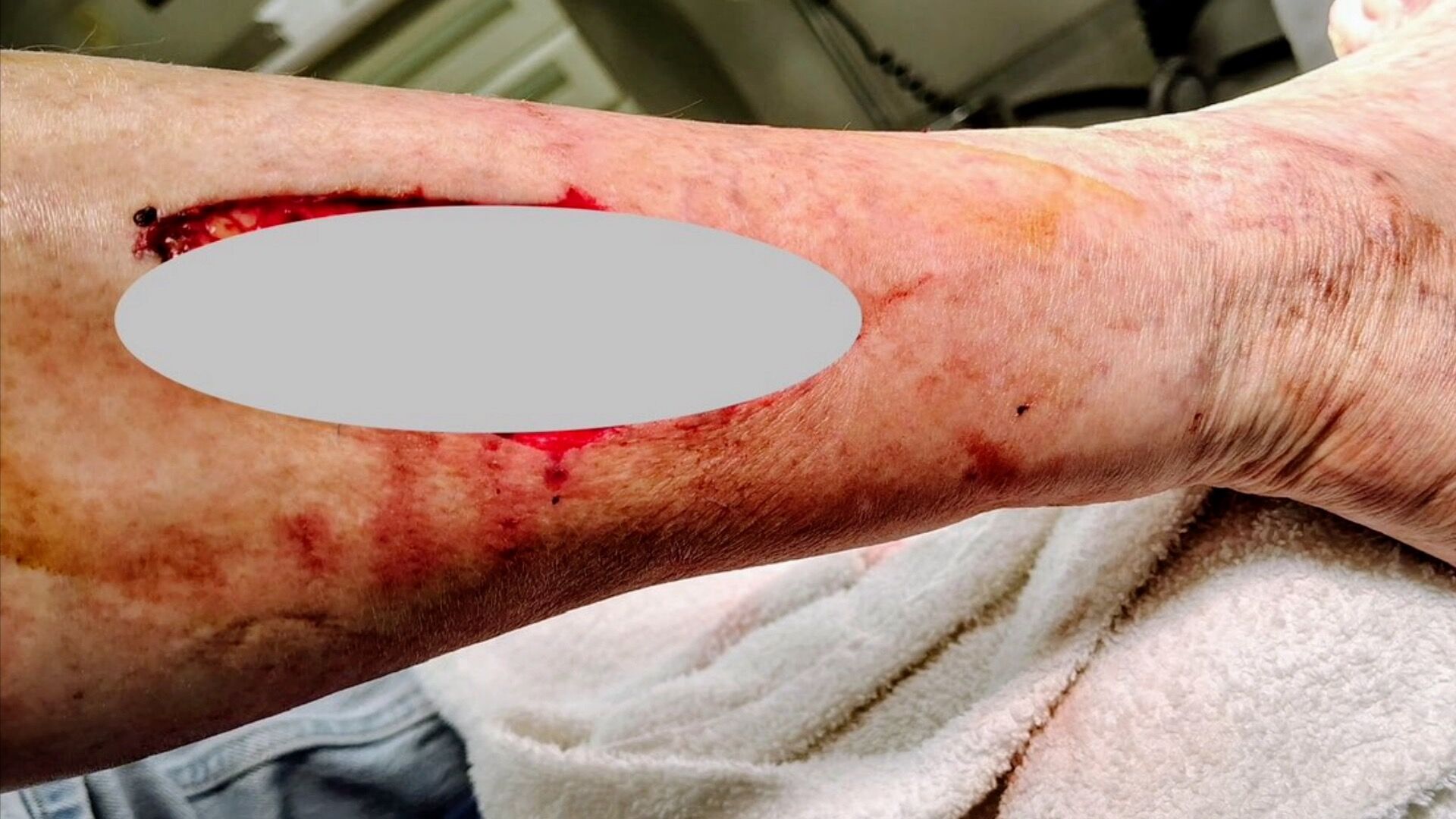 Dog attacked man at Baldwyn gas station | | wtva.com